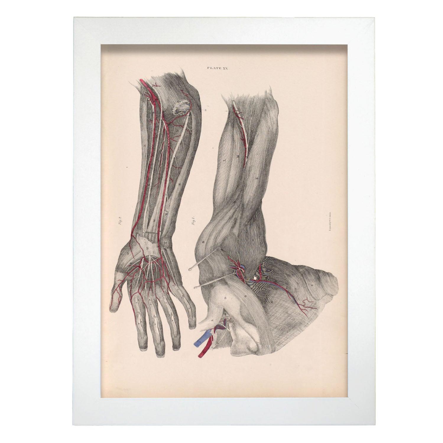 Affiche Pour La Dissection Du Bras Décoratives De L'anatomie Et De La ...