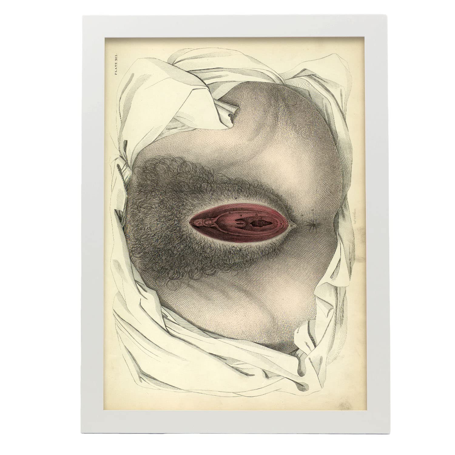 Affiche Sur La Dissection Génitale Féminine Décoratives De L'anatomie ...