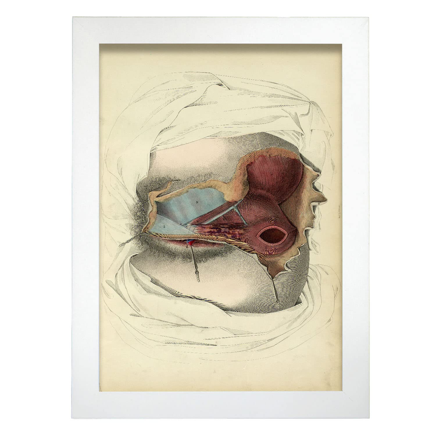 Poster A Dissezione Perinea Illustrazioni Decorative Di Anatomia E ...